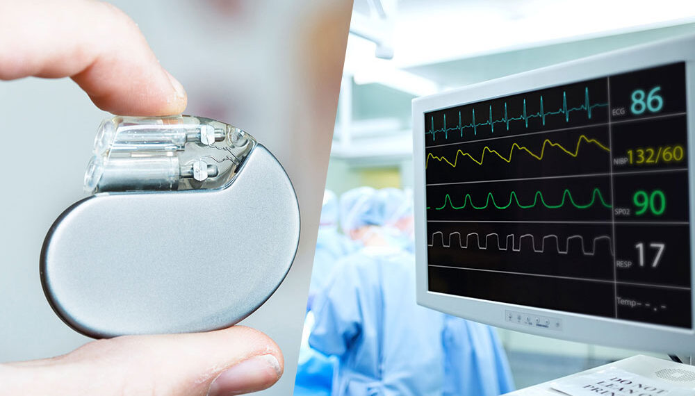Improve Quality of Connected Medical Devices: Effective Manufacturing ...