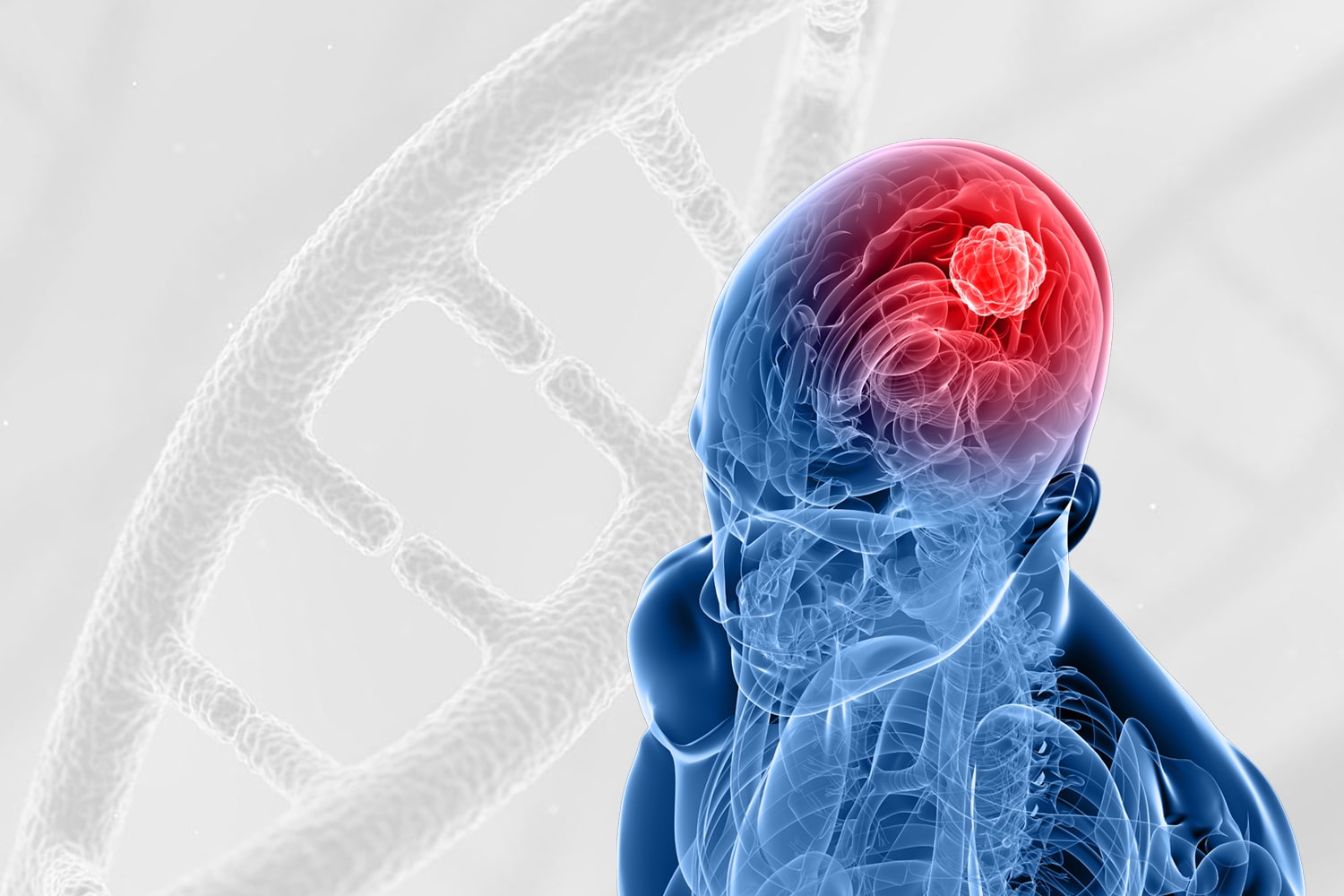 Oncologica’s New Research on Detection of Brain Cancer Biomarkers by ...