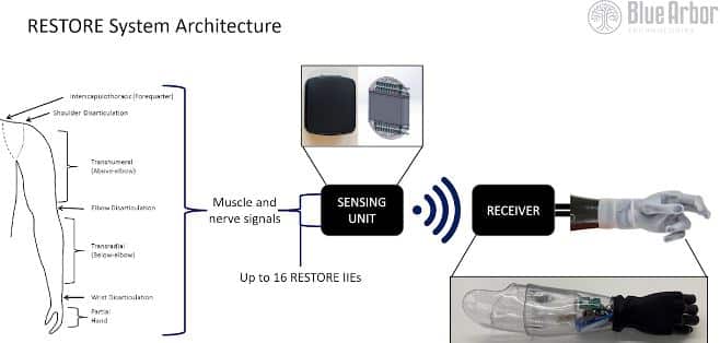 Blue Arbor's RESTORE Neuromuscular Interface System Granted